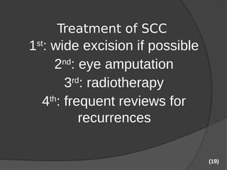 Conjunctival Squamous Cell Carcinoma | PDF