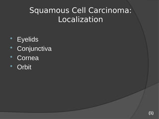 Conjunctival Squamous Cell Carcinoma | PDF