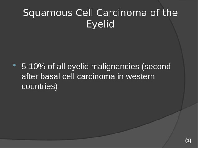 Conjunctival Squamous Cell Carcinoma | PDF | Eye and Vision Conditions ...