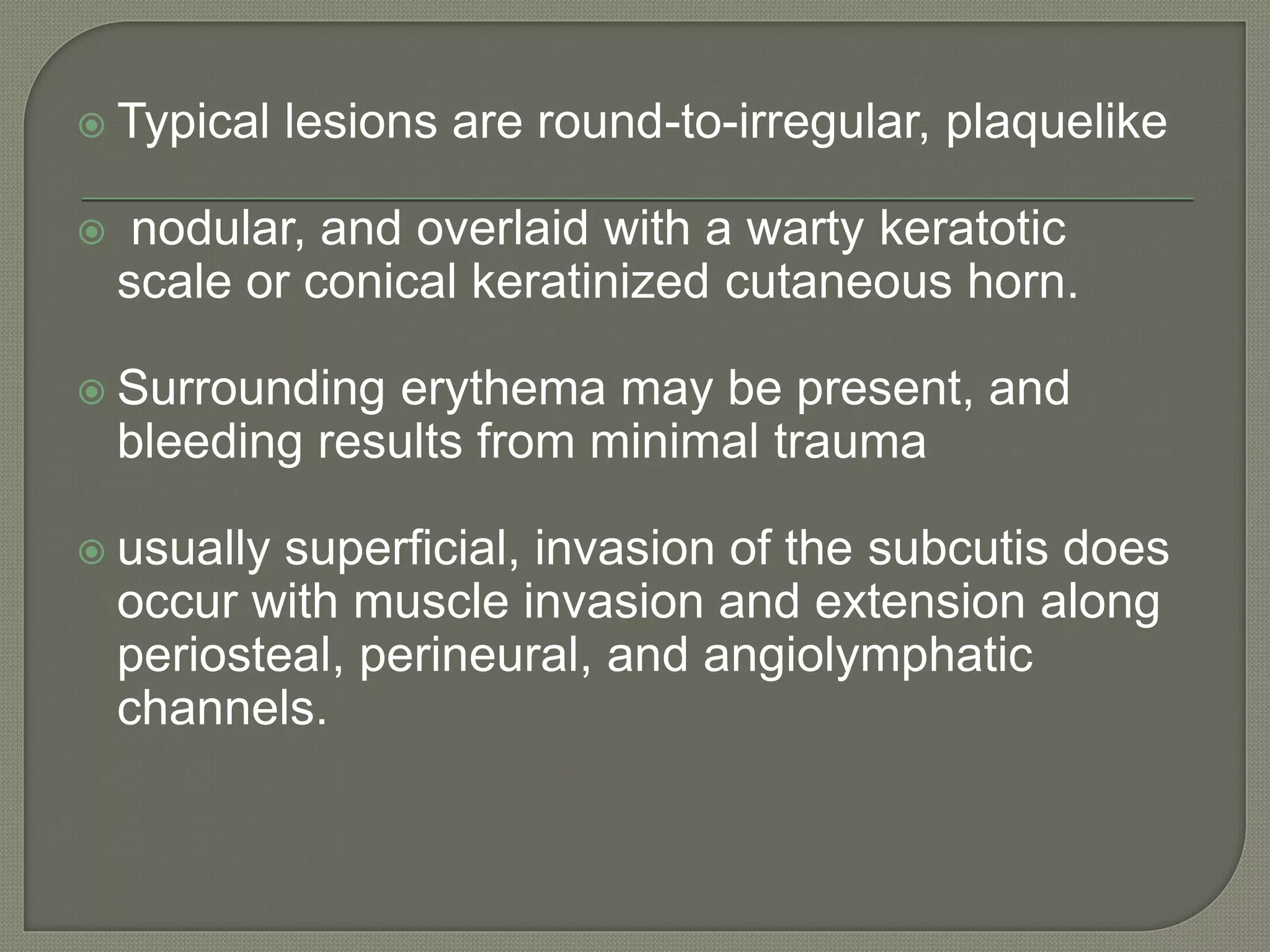 Squamous cell carcinoma skin | PPTX