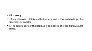 SQUAMOUS PAPILLOMA.pathology bds practical pptx | PPTX