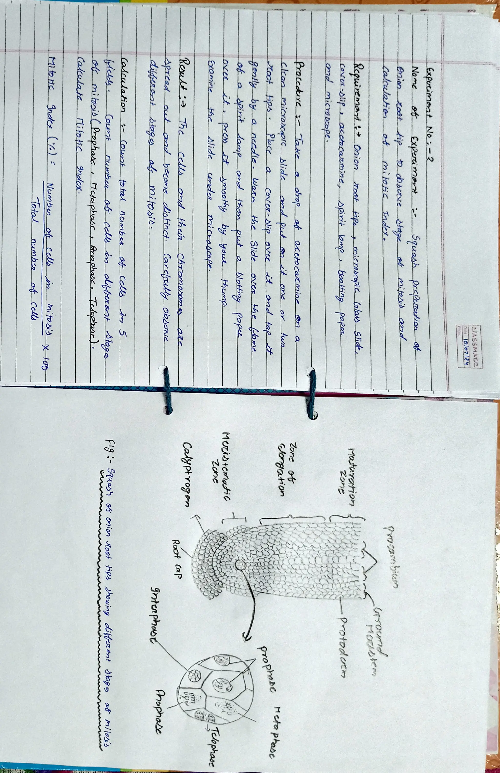 Squash preperation of Onion root tip for mitosis.pdf