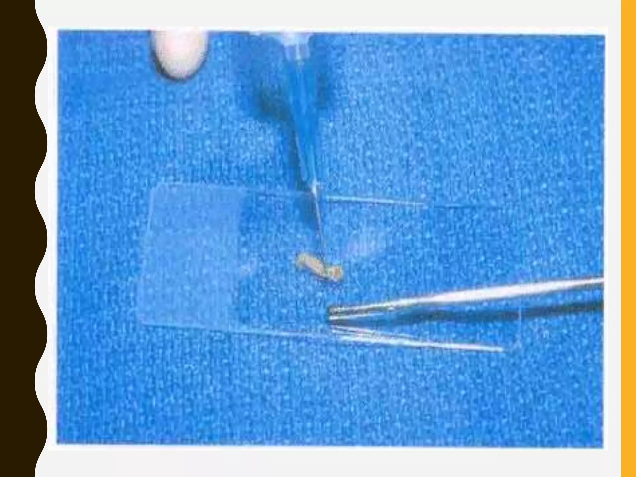 Squash smear cytology - By Anamika dev | PPTX