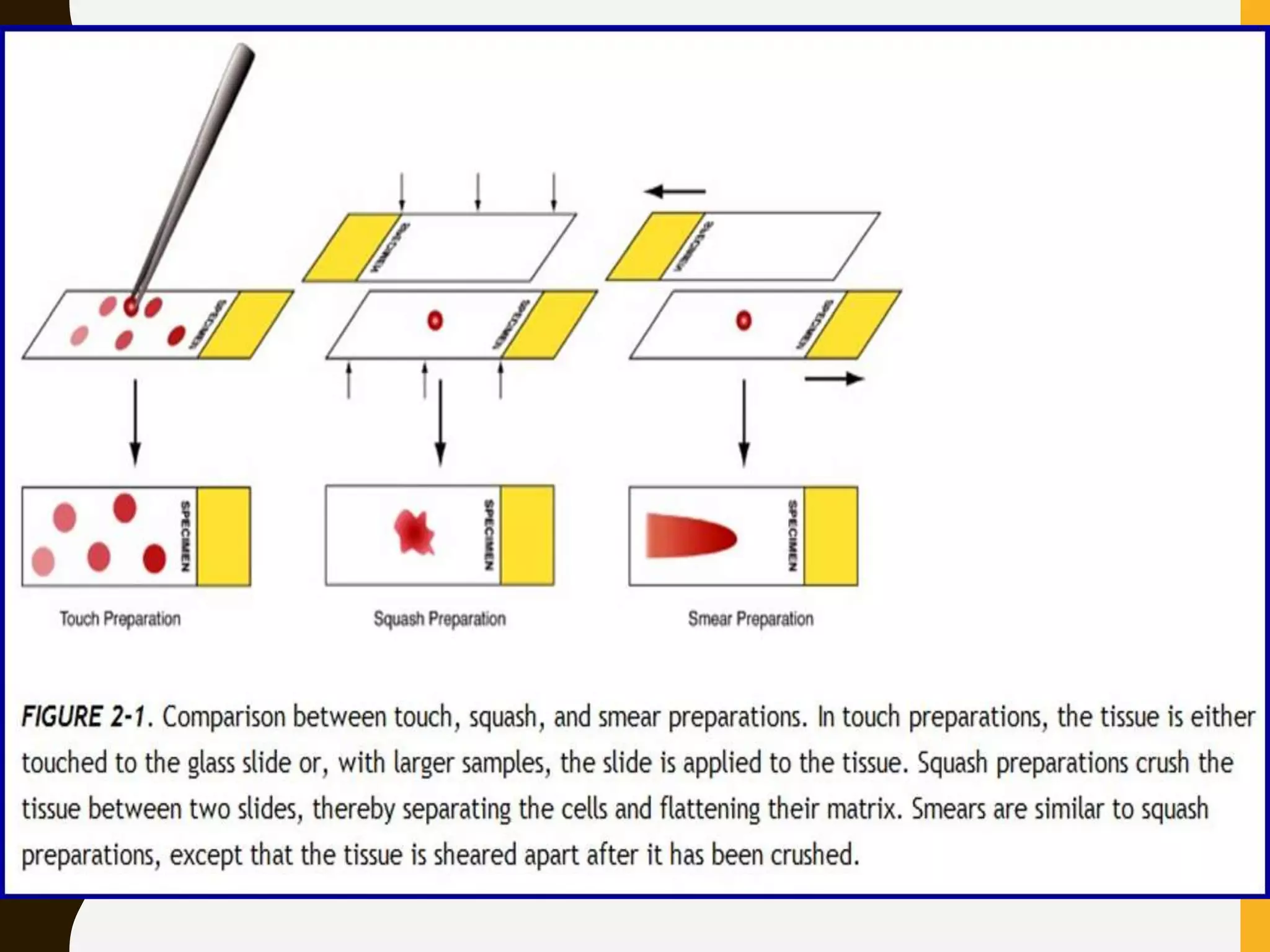 Squash smear cytology - By Anamika dev | PPTX