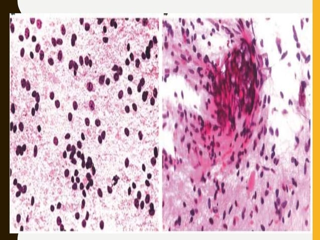 Squash smear cytology - By Anamika dev | PPTX