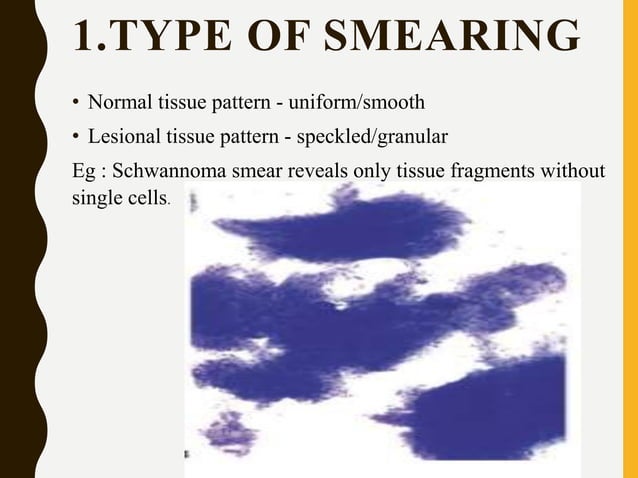 Squash smear cytology - By Anamika dev | PPTX