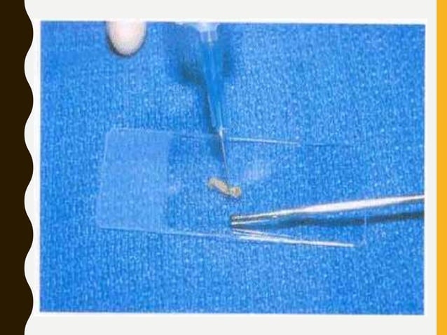 Squash smear cytology - By Anamika dev | PPTX