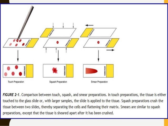 Squash smear cytology - By Anamika dev