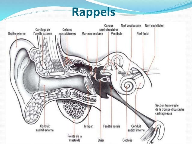 Séquelles en otologie (1)