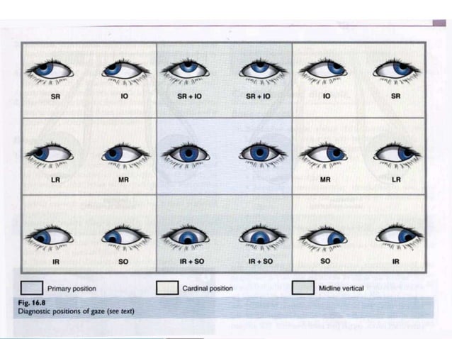 Squint | PPTX