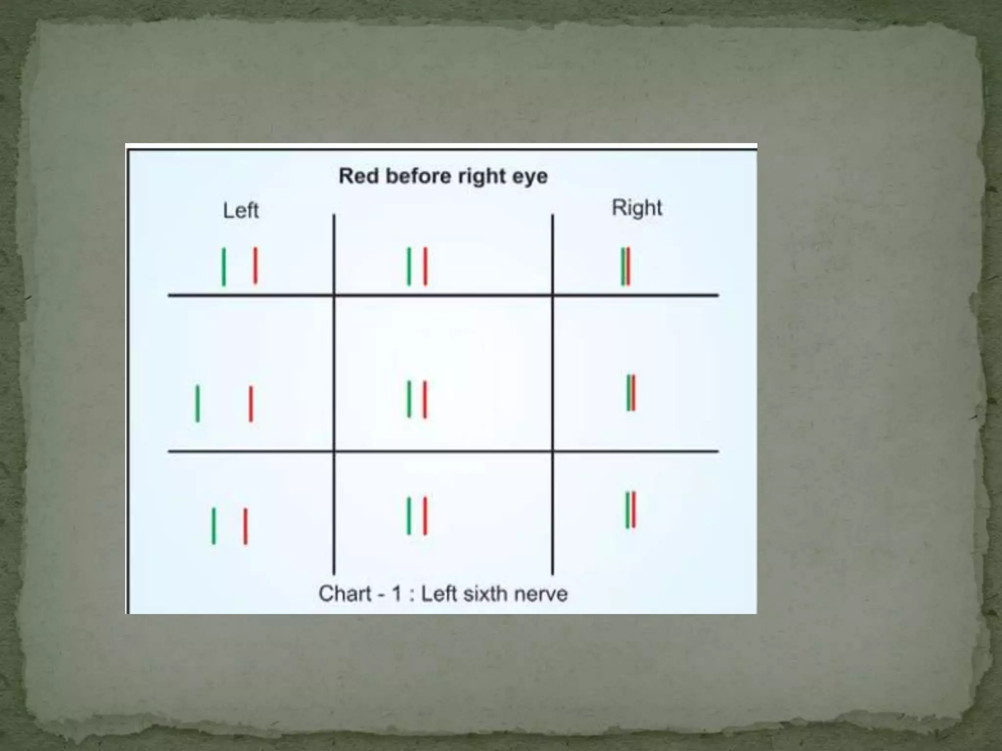 evaluation of strabismus | PPTX