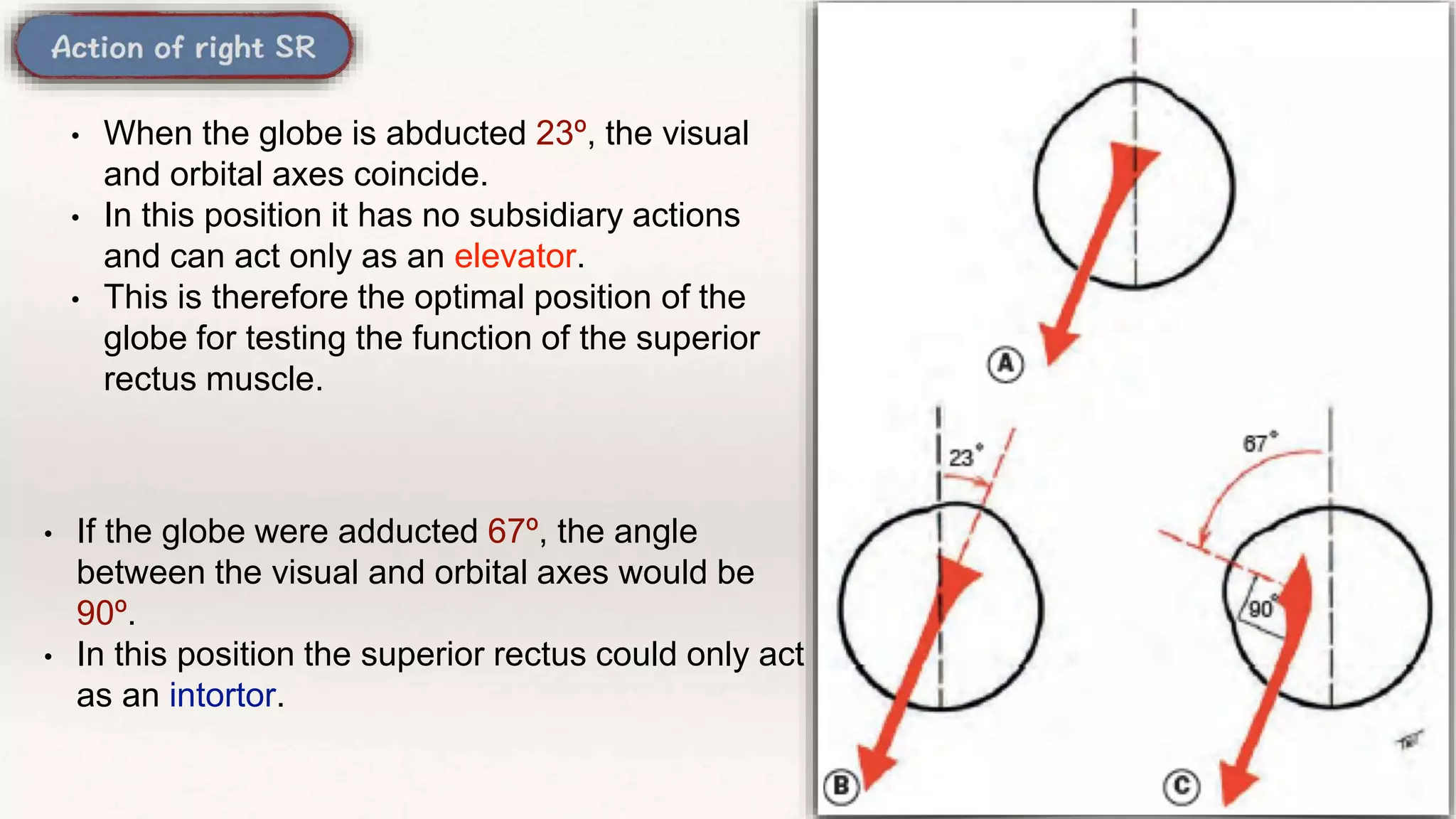 Squint (Anatomy, phsiology) | PPTX