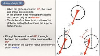 Squint (Anatomy, phsiology) | PPTX