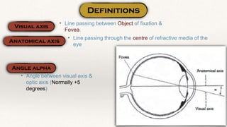 Squint (Anatomy, phsiology) | PPTX