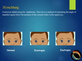 squint assessment optom Anamul haq | PPTX | Eye and Vision Conditions ...