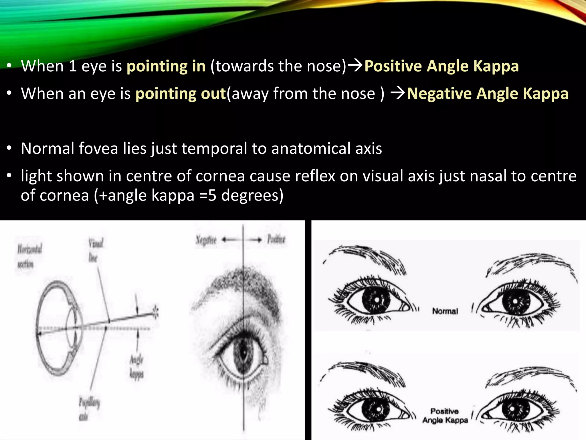 Clinical examination of squint | PPTX