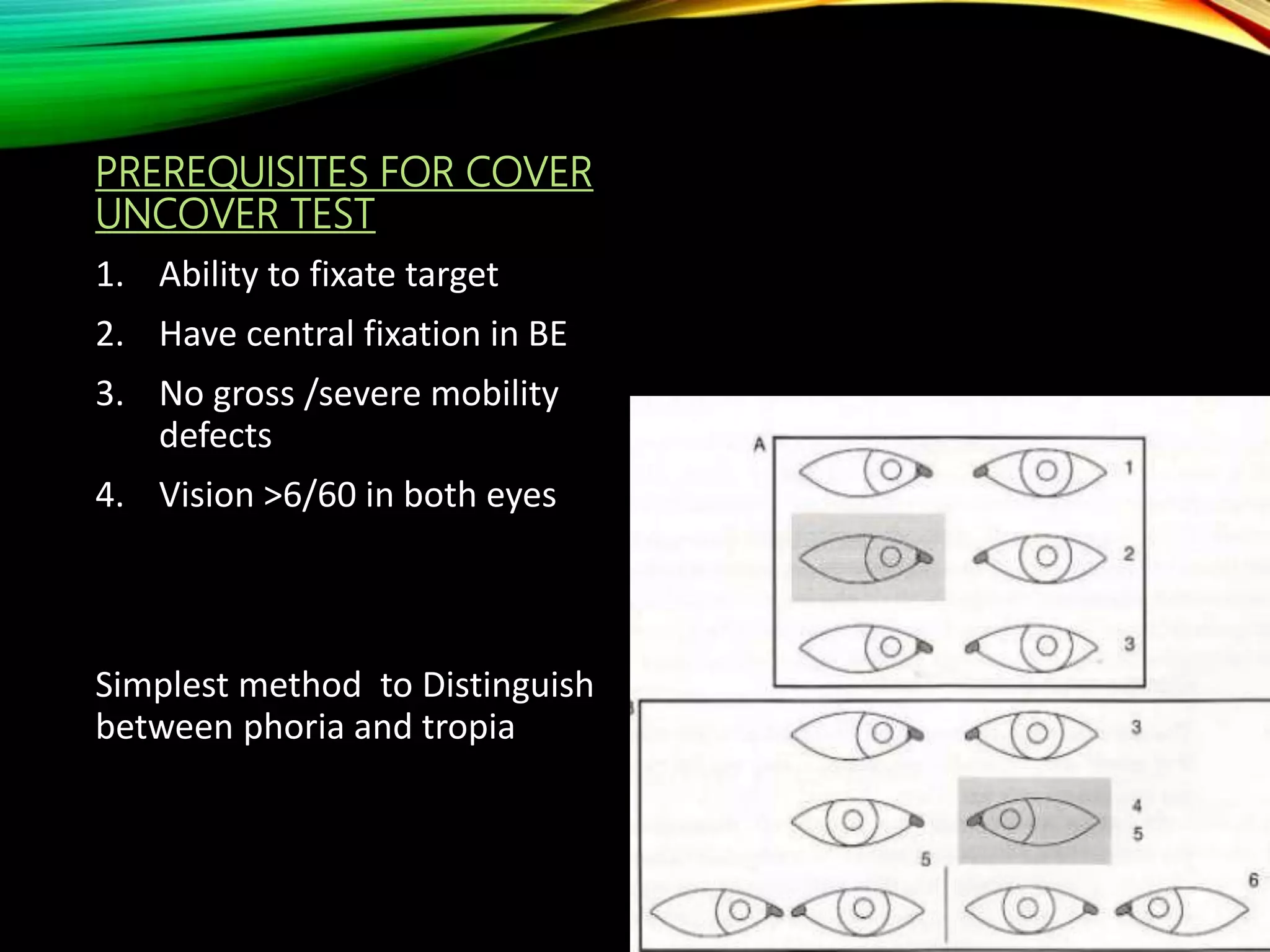 Clinical examination of squint | PPTX
