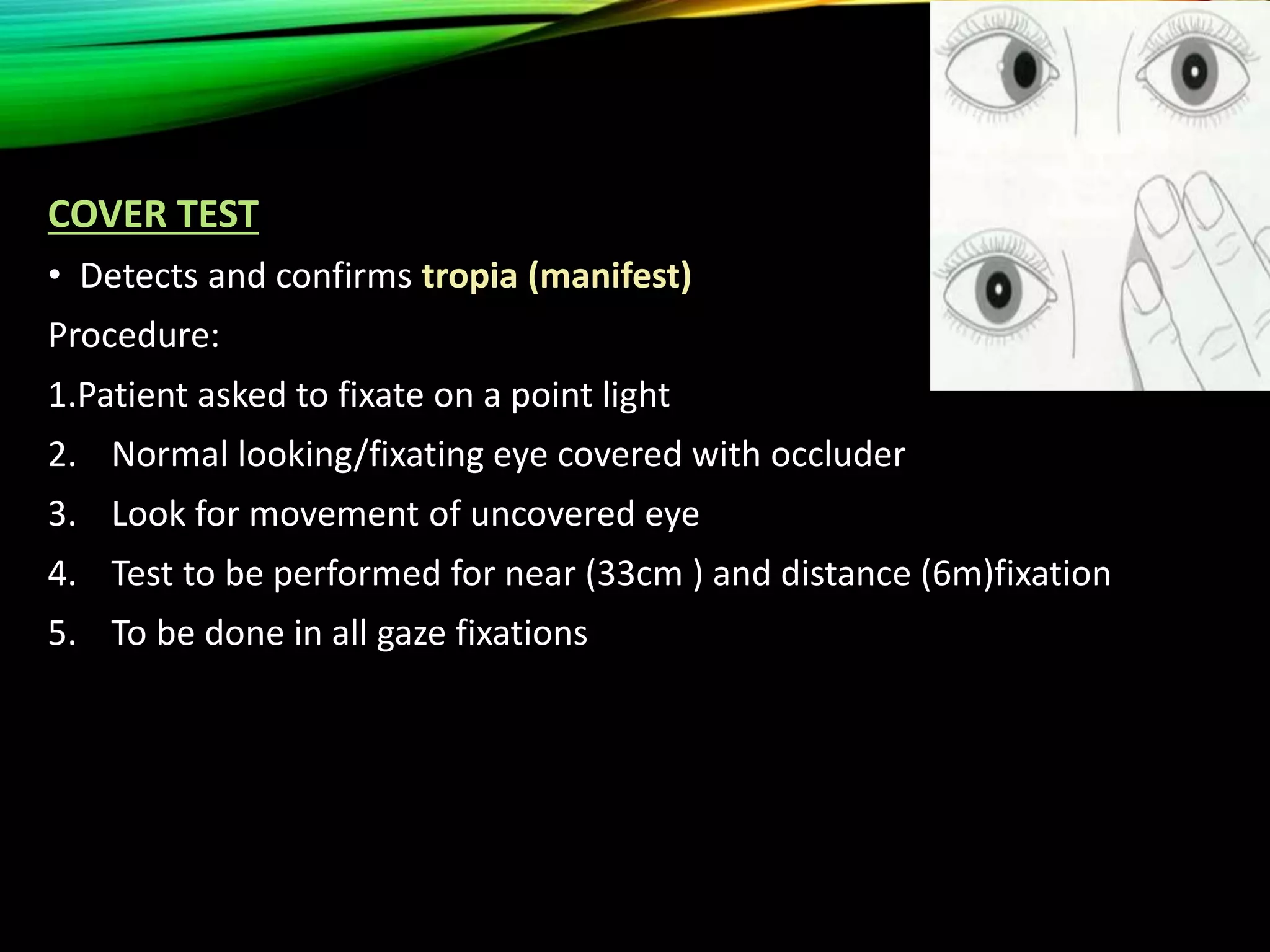 Clinical examination of squint | PPTX