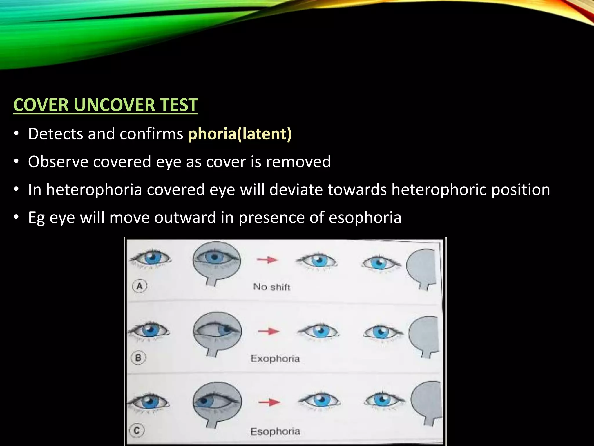 Clinical examination of squint | PPTX