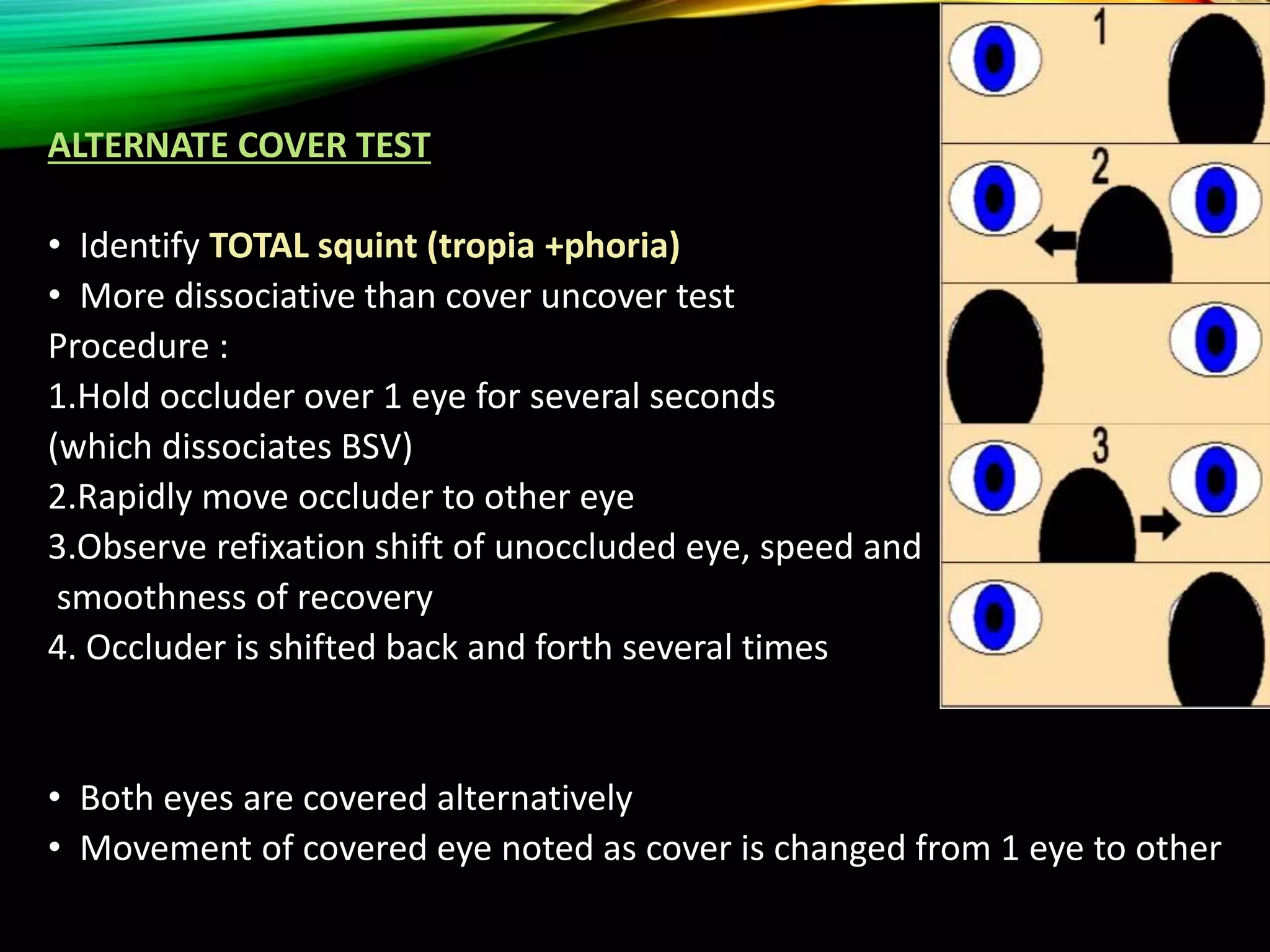 Clinical examination of squint | PPTX