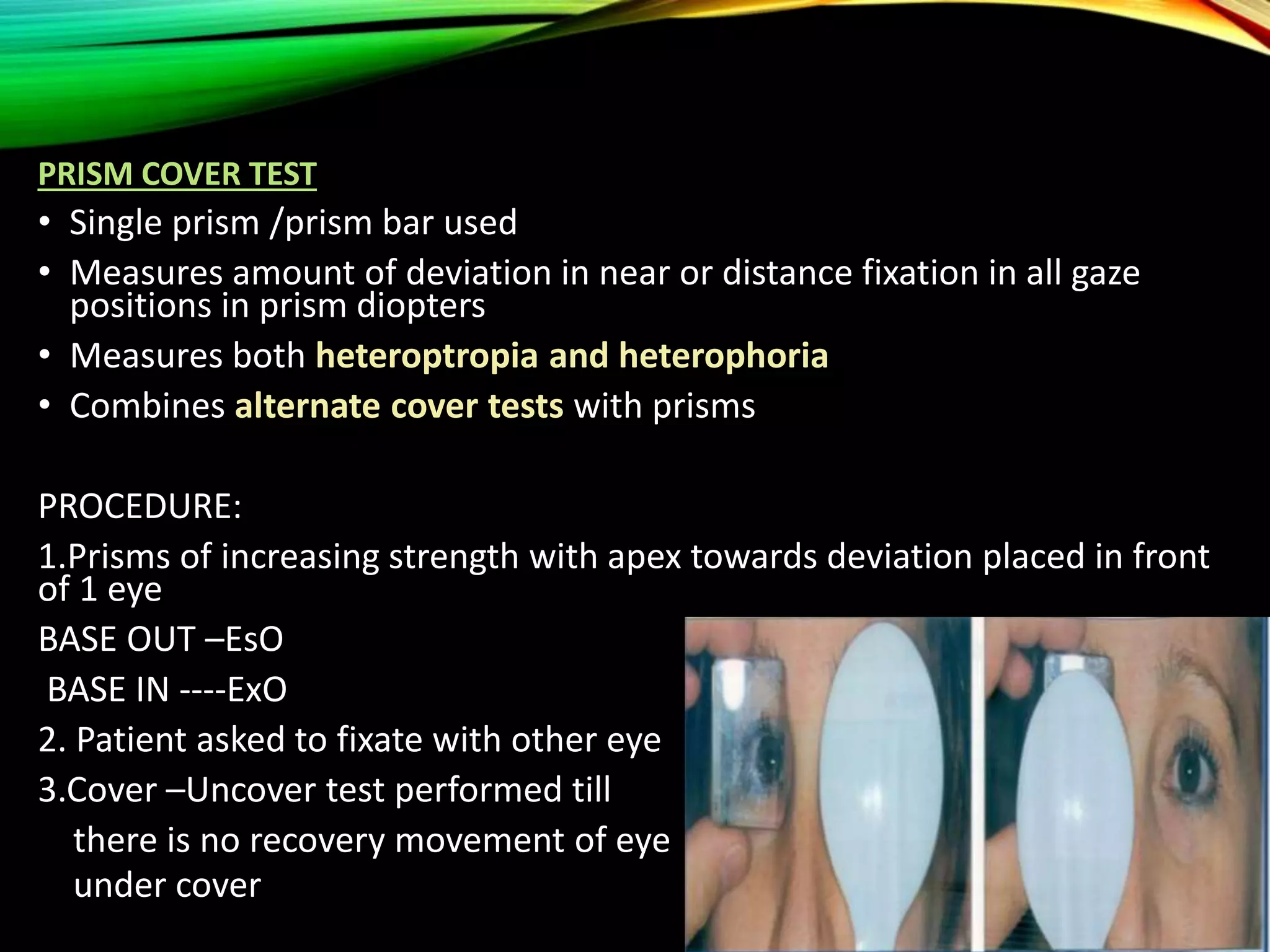 Clinical examination of squint | PPTX