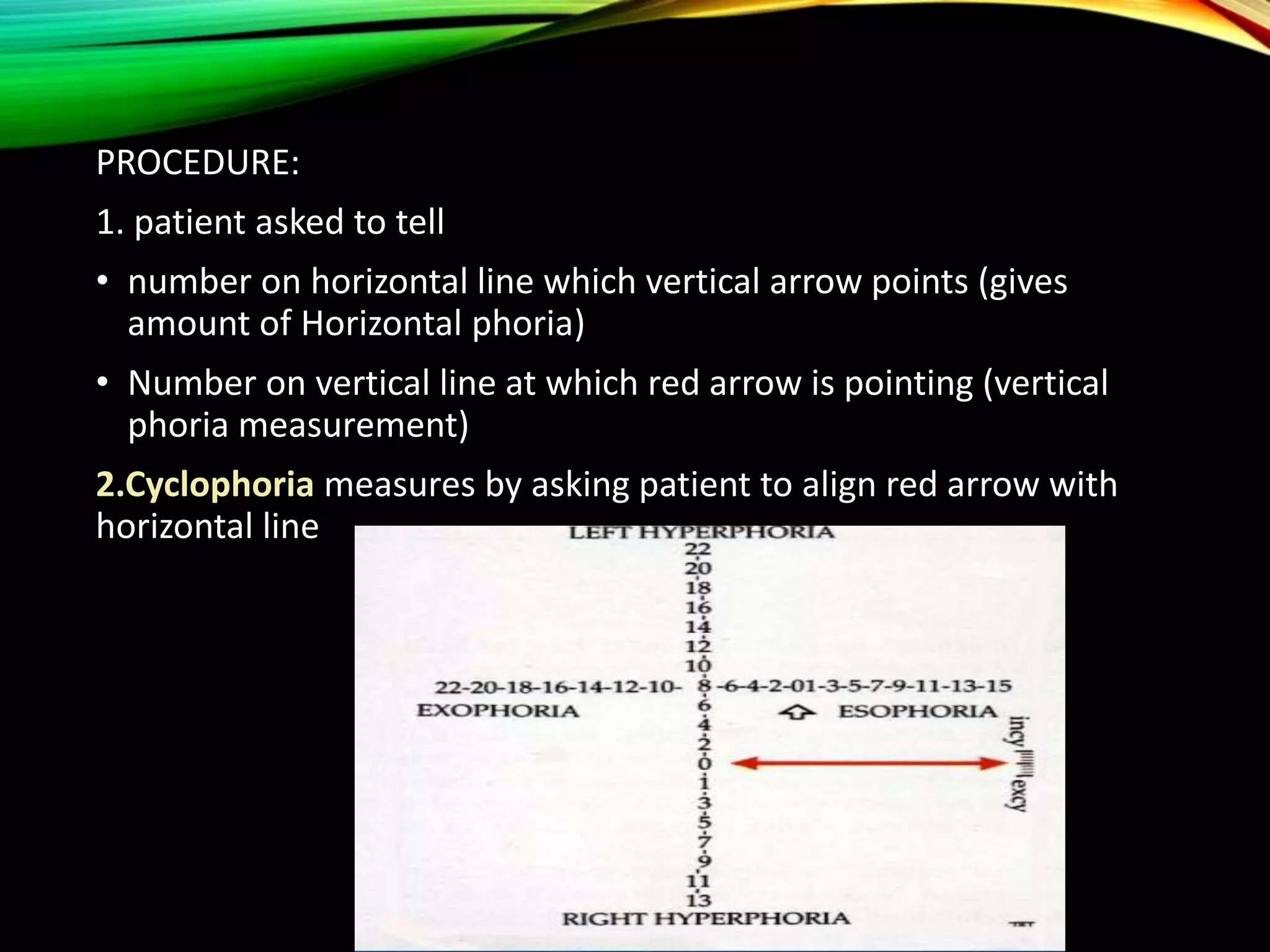 Clinical examination of squint | PPTX