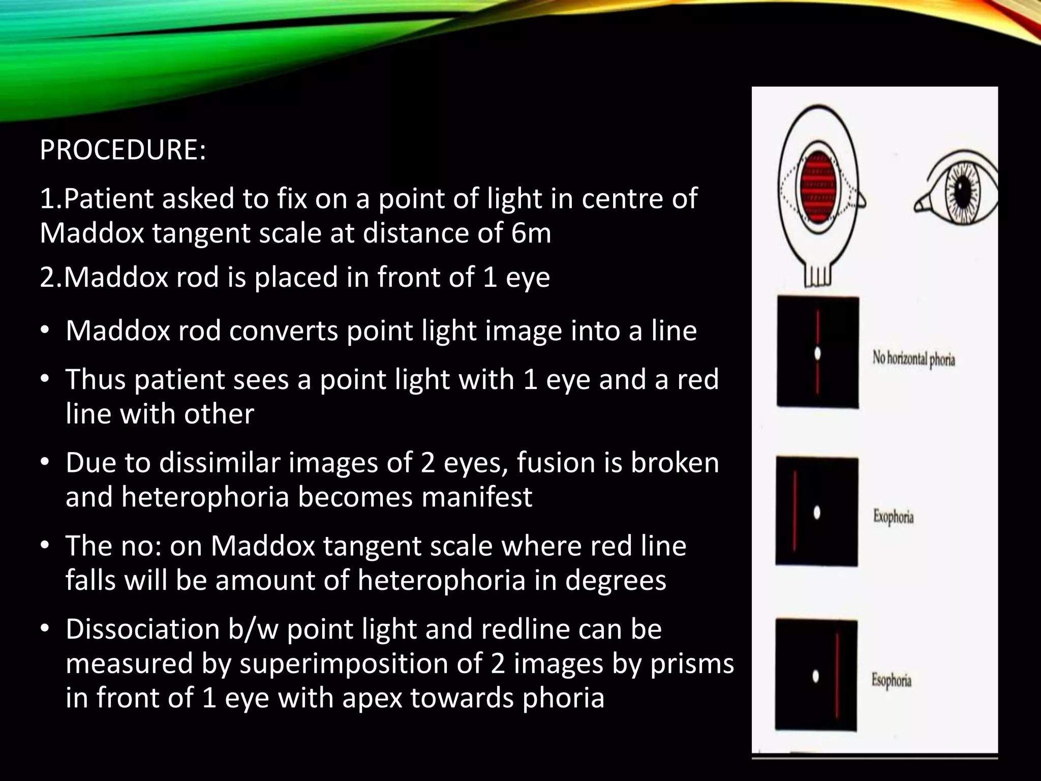 Clinical examination of squint | PPTX