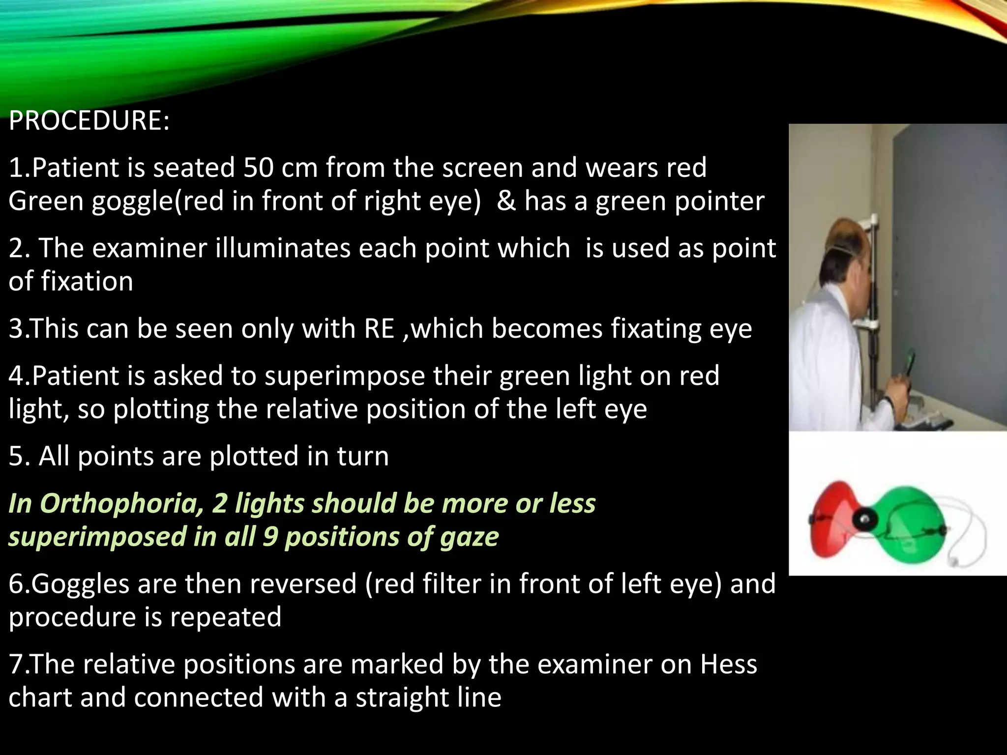 Clinical examination of squint | PPTX