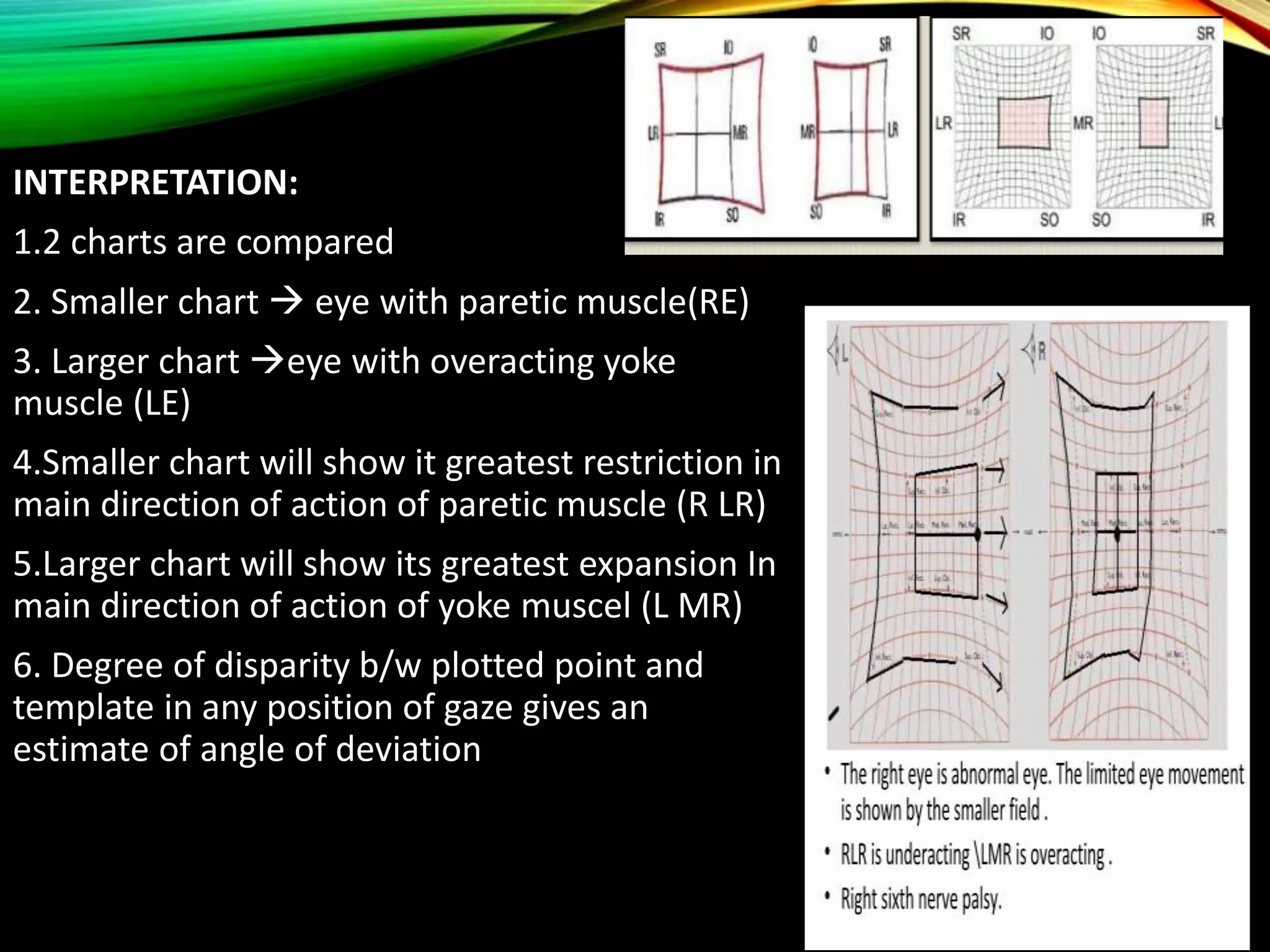 Clinical examination of squint | PPTX