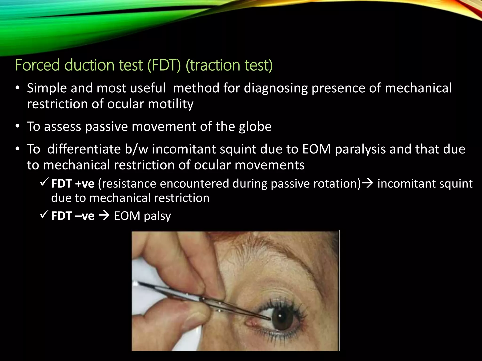Clinical examination of squint | PPTX