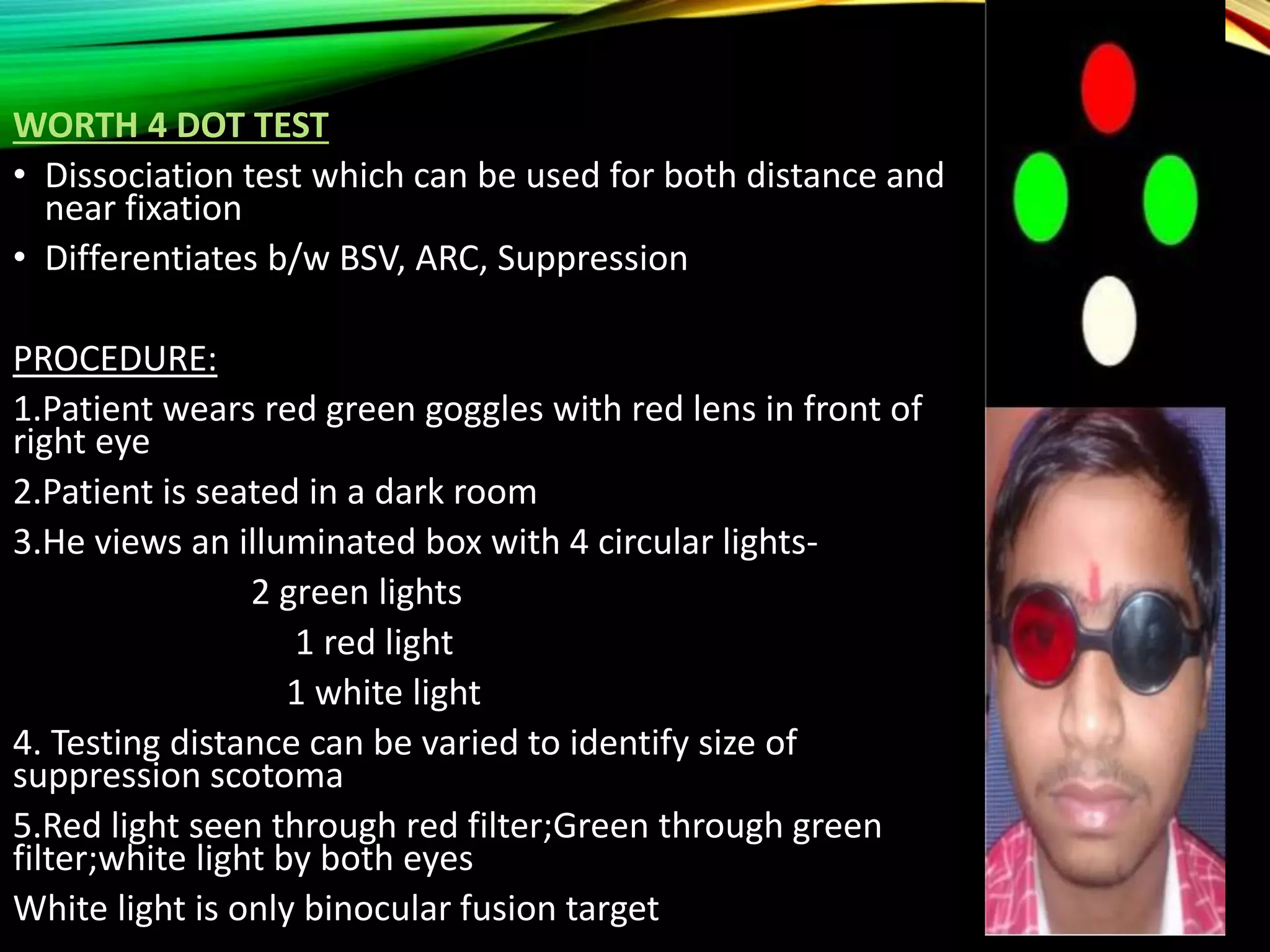 Clinical examination of squint | PPTX