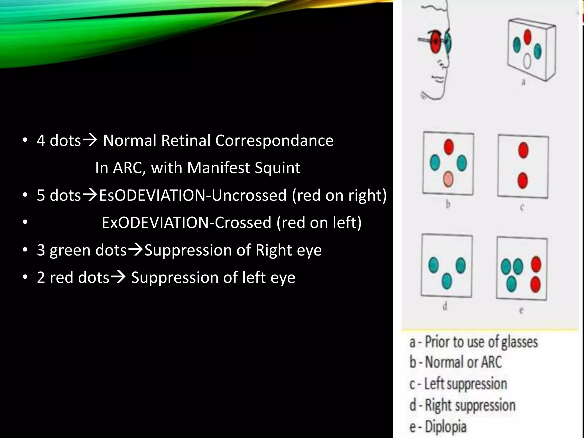Clinical examination of squint | PPTX