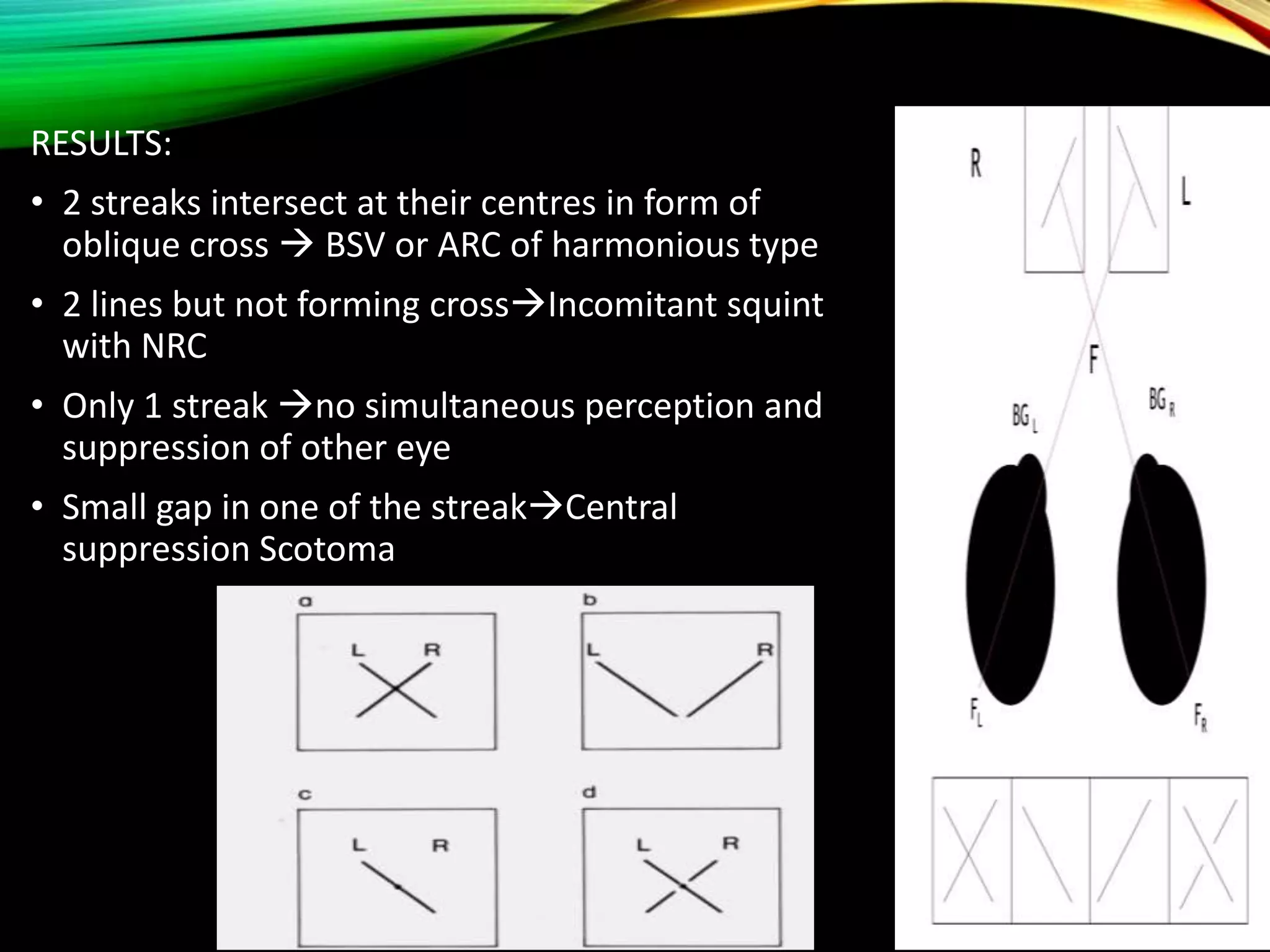 Clinical examination of squint | PPTX