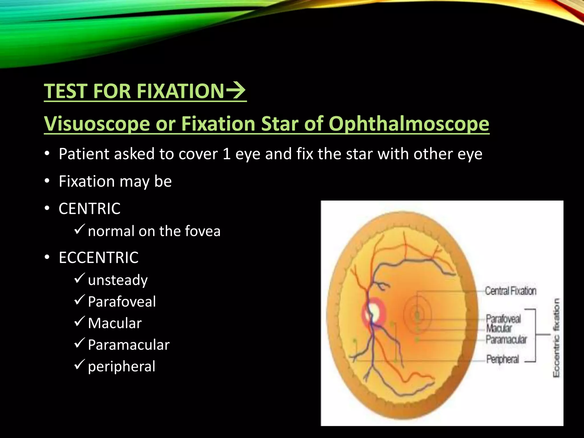 Clinical examination of squint | PPTX