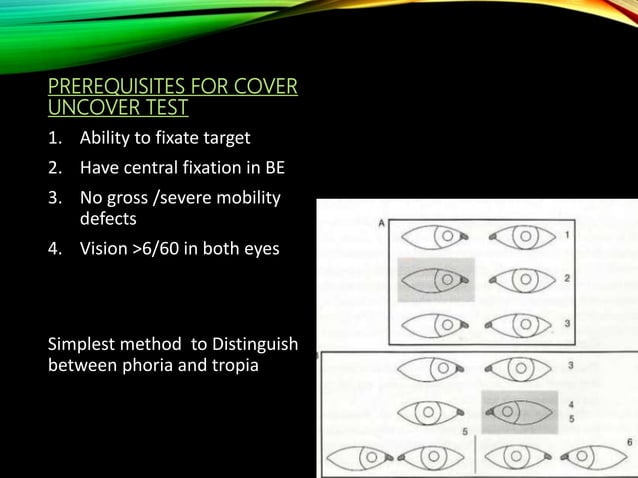 Clinical examination of squint | PPT