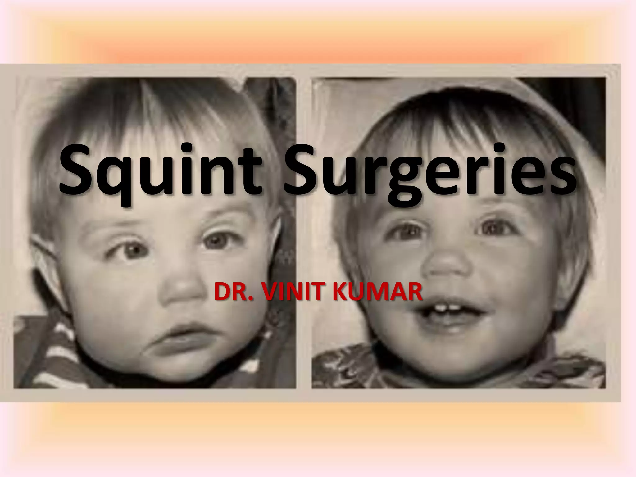 Squint surgeries basics from DR. VINIT | PPTX
