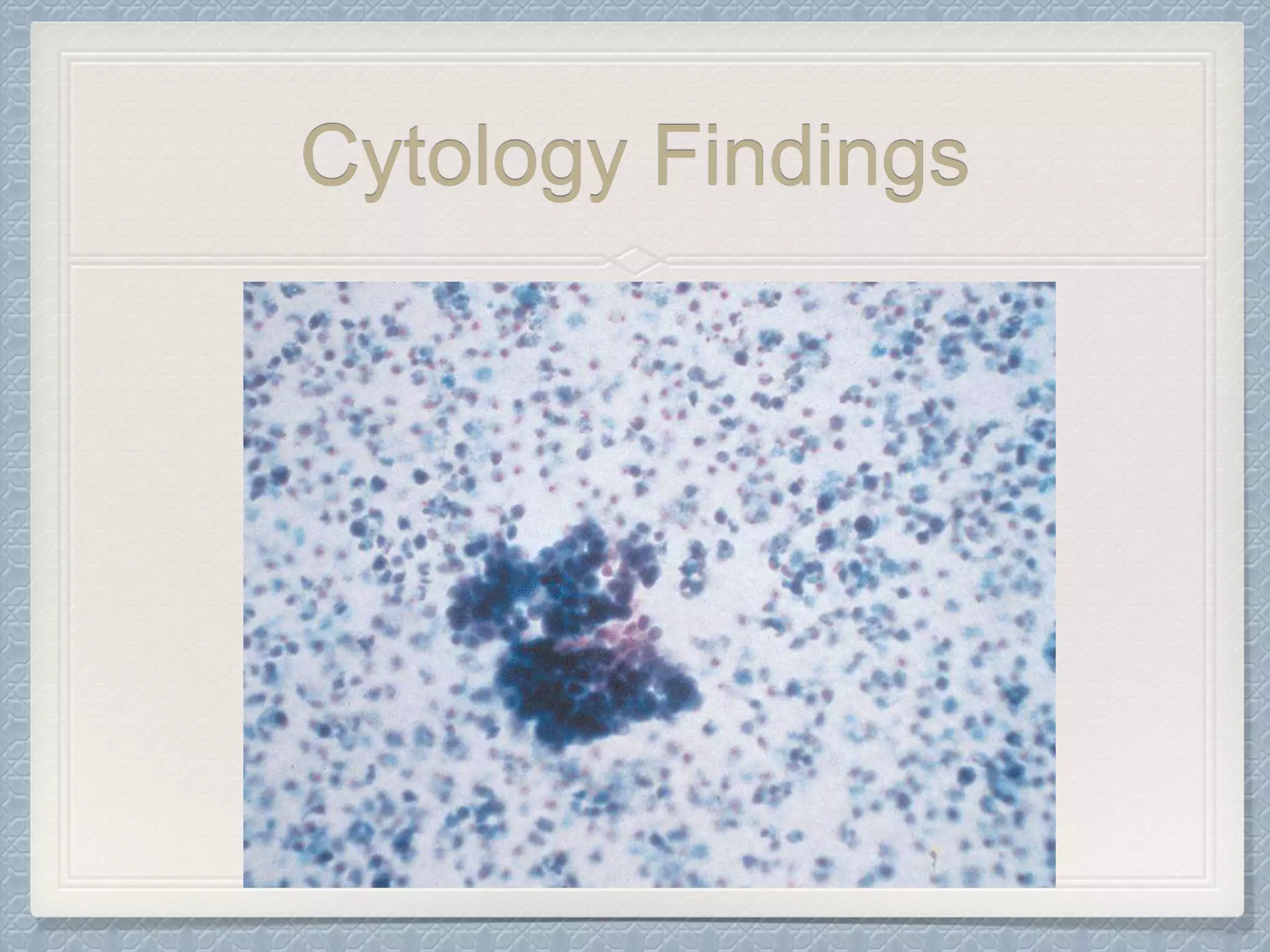 Small round cell tumors | PPTX