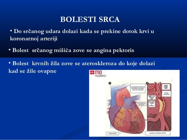 Srce i krvožilni sustav