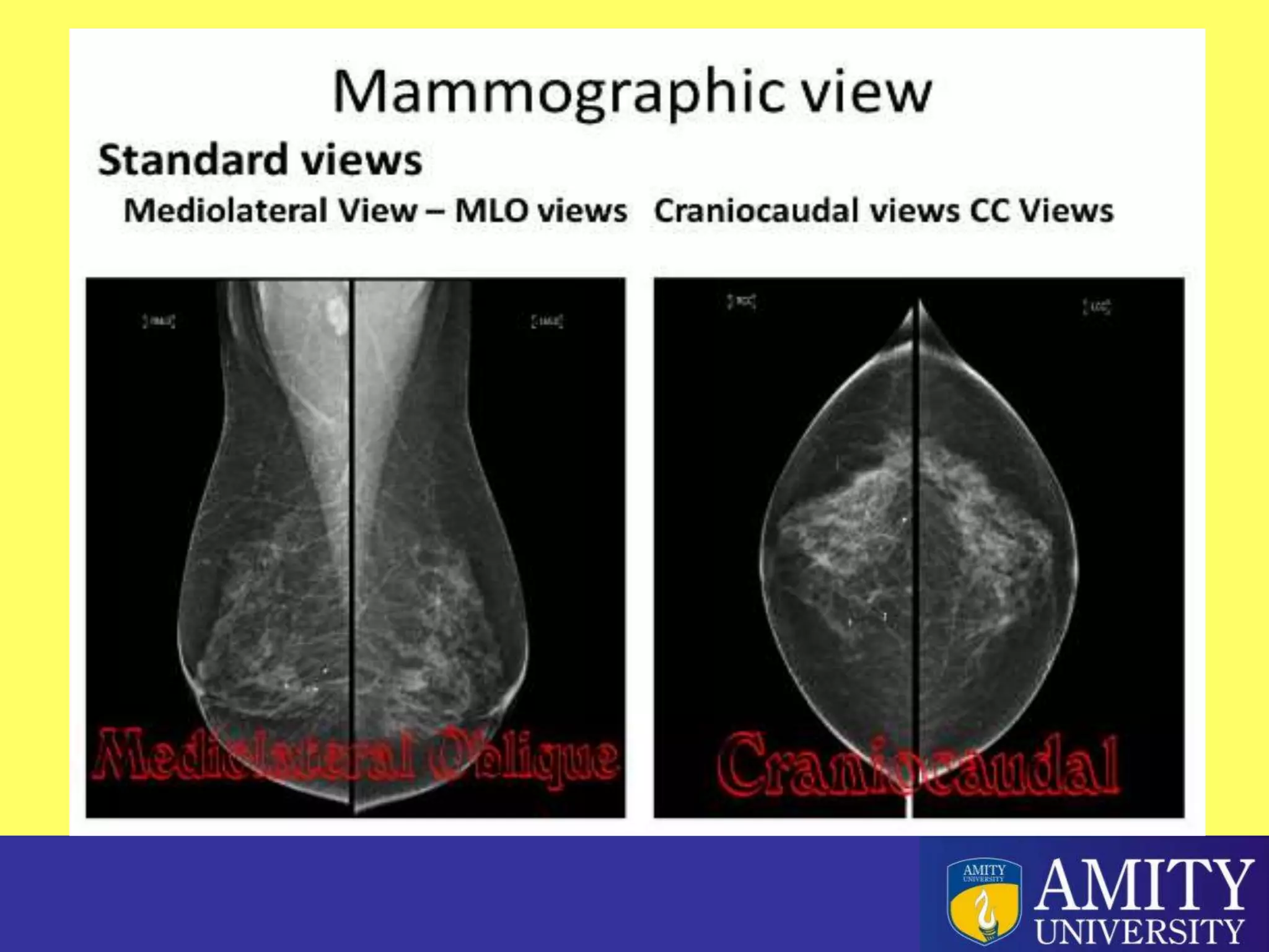 Design Of Modified Bio Inspired Algorithm For Identification And
