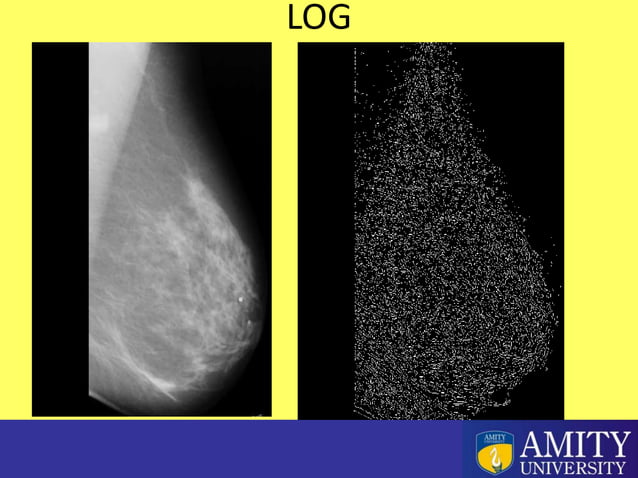 Design Of Modified Bio Inspired Algorithm For Identification And Segmentation Of Pectoral Muscle