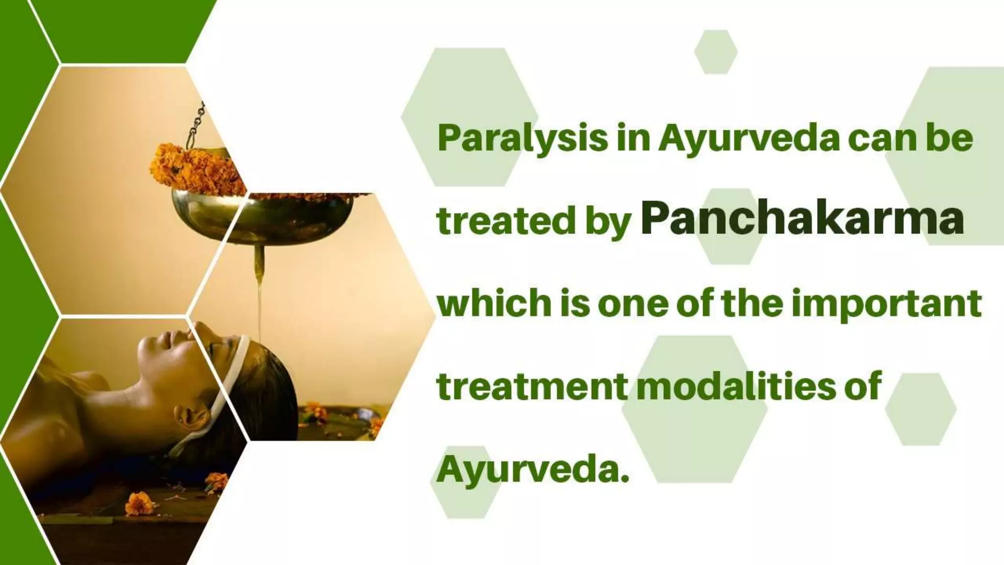Panchakarma treatment for paralysis in Ayurveda. | PPTX