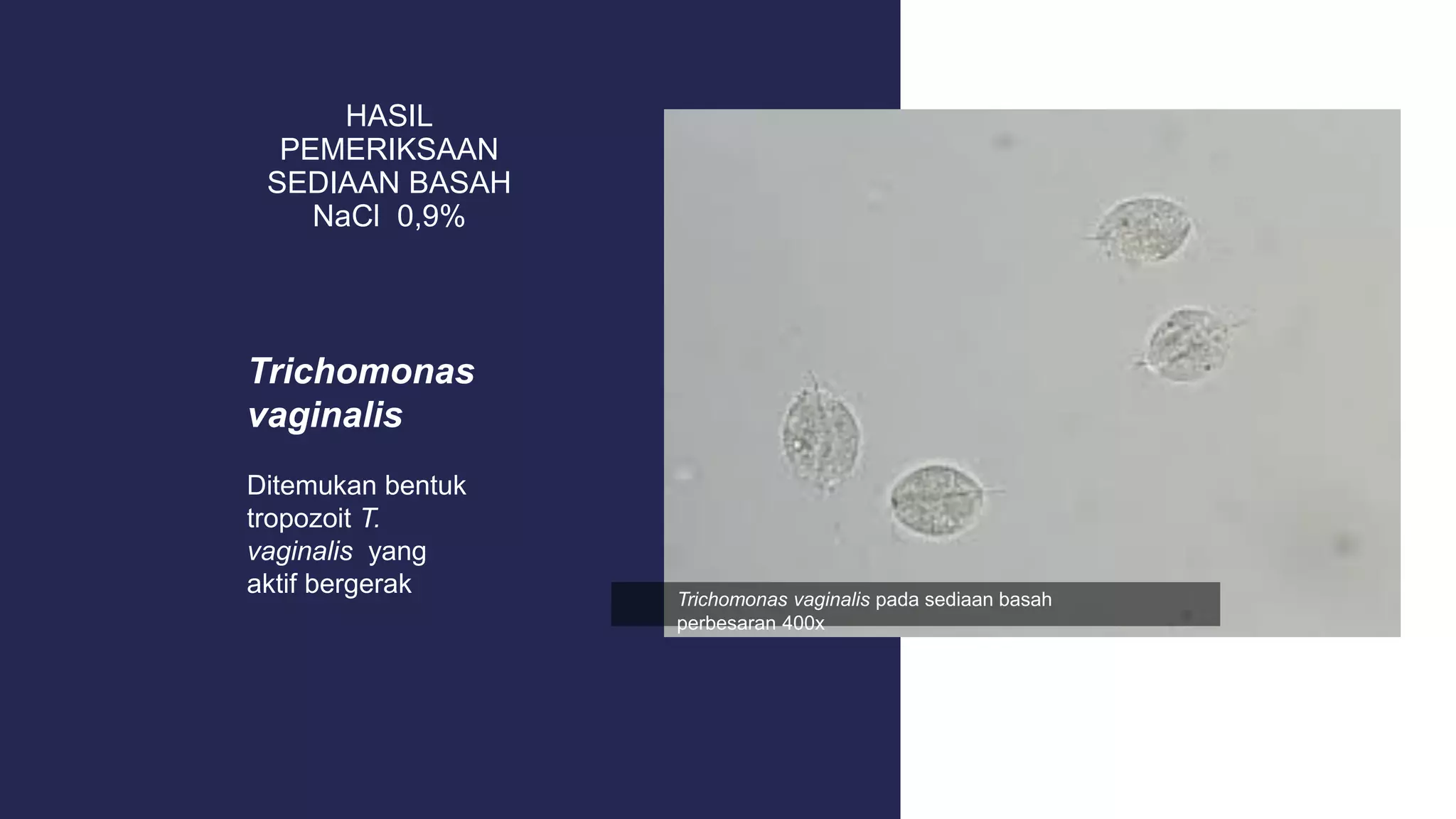 Sri aminingsih puskesmas todanan kelas e_m3_px sediaan basah nacl 0.9% ...
