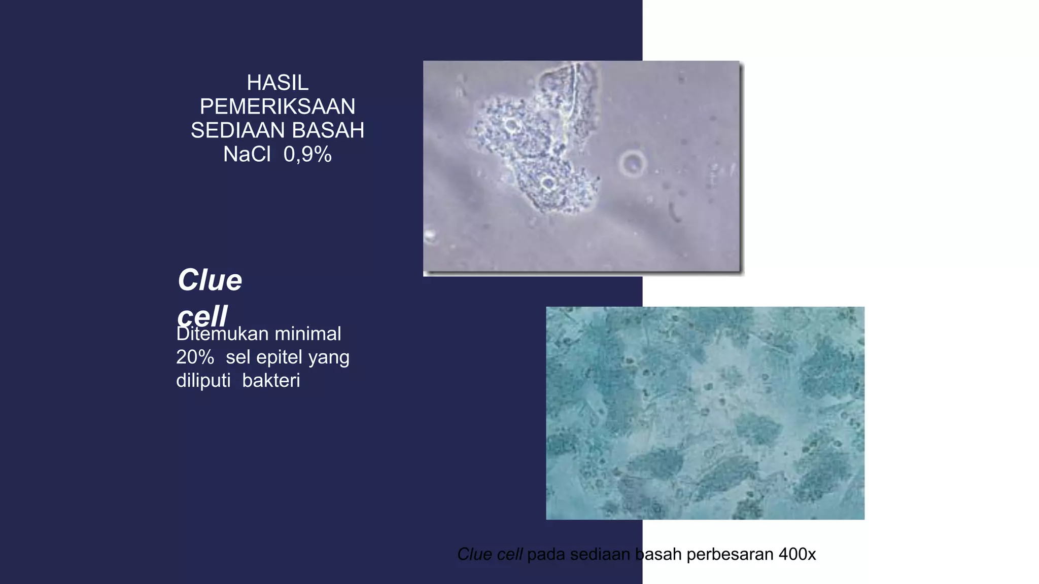 Sri aminingsih puskesmas todanan kelas e_m3_px sediaan basah nacl 0.9% ...