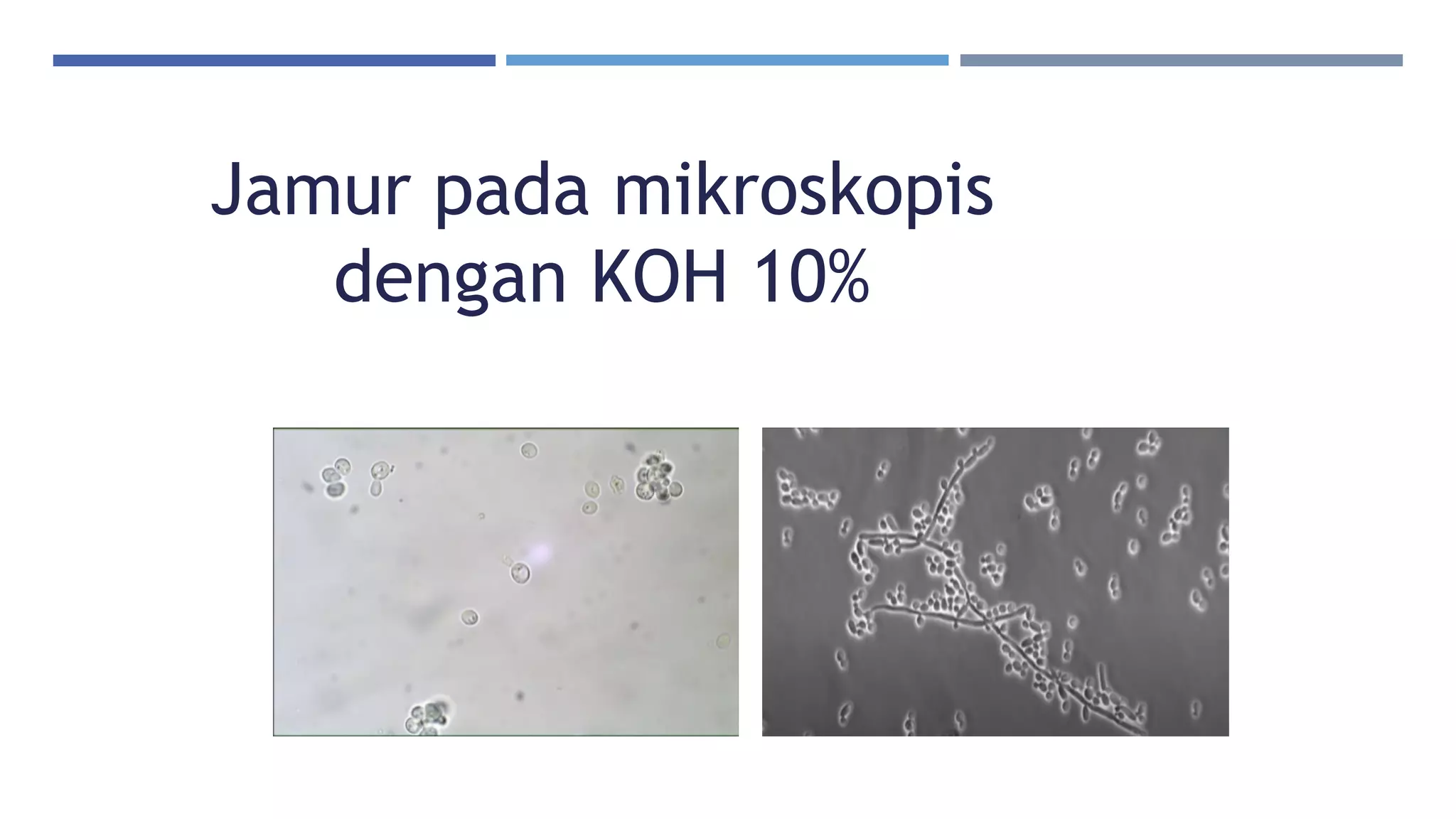 Sri aminingsih puskesmas todanan kelas e_m3_px sediaan basah nacl 0.9% ...