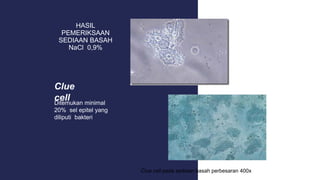 Sri aminingsih puskesmas todanan kelas e_m3_px sediaan basah nacl 0.9% ...