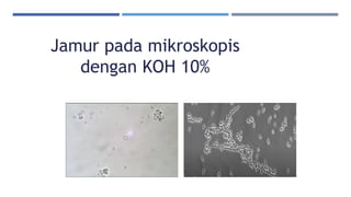Sri aminingsih puskesmas todanan kelas e_m3_px sediaan basah nacl 0.9% ...
