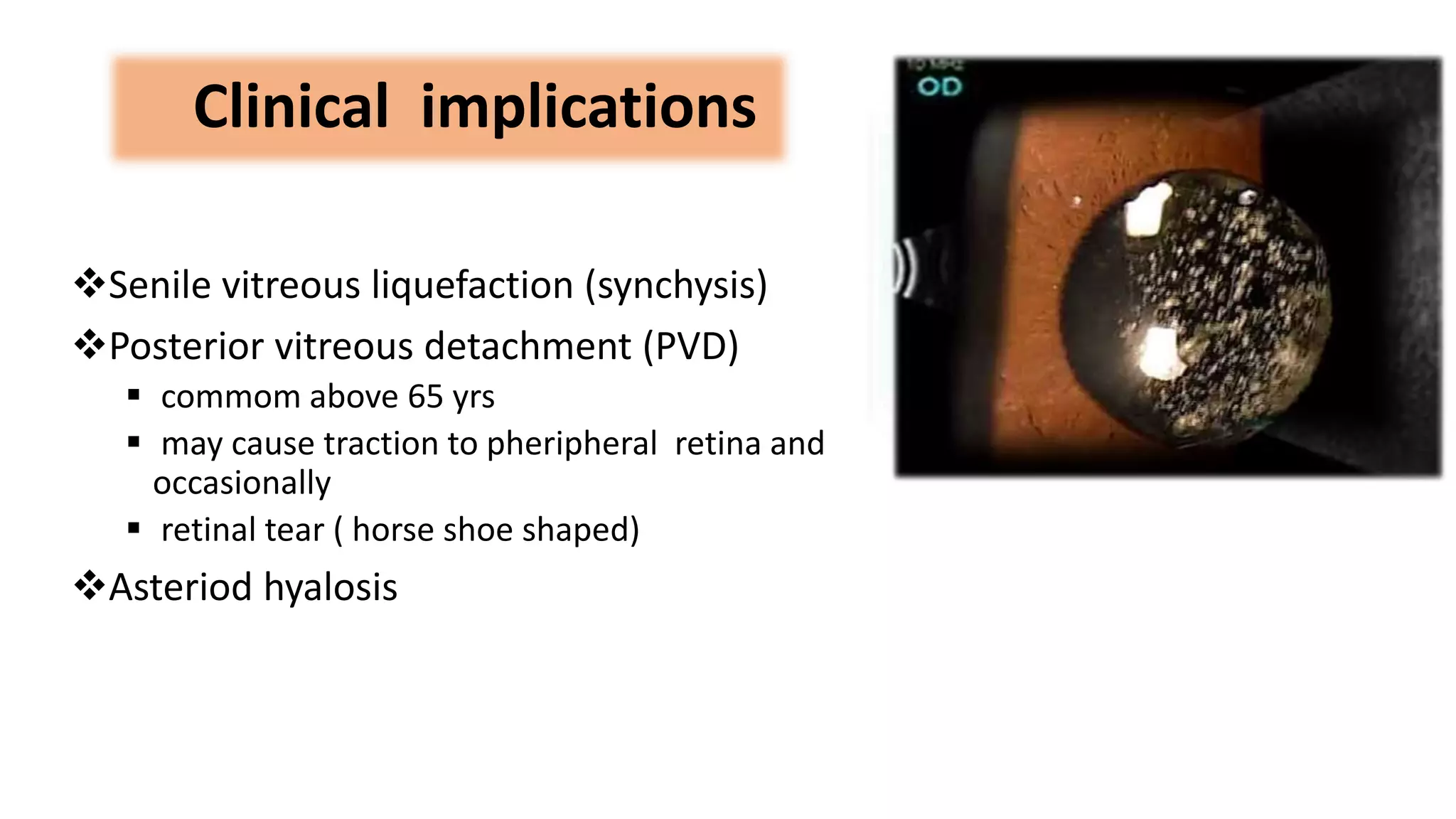 eye and vision in adulthood | PPTX