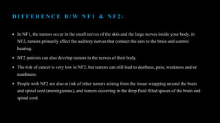 Neurofibromatosis | PPTX