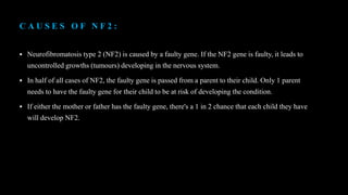 Neurofibromatosis | PPTX