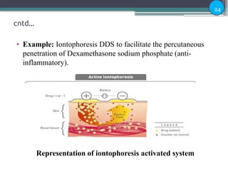 Stimulli Activated Drug Delivery System.pptx